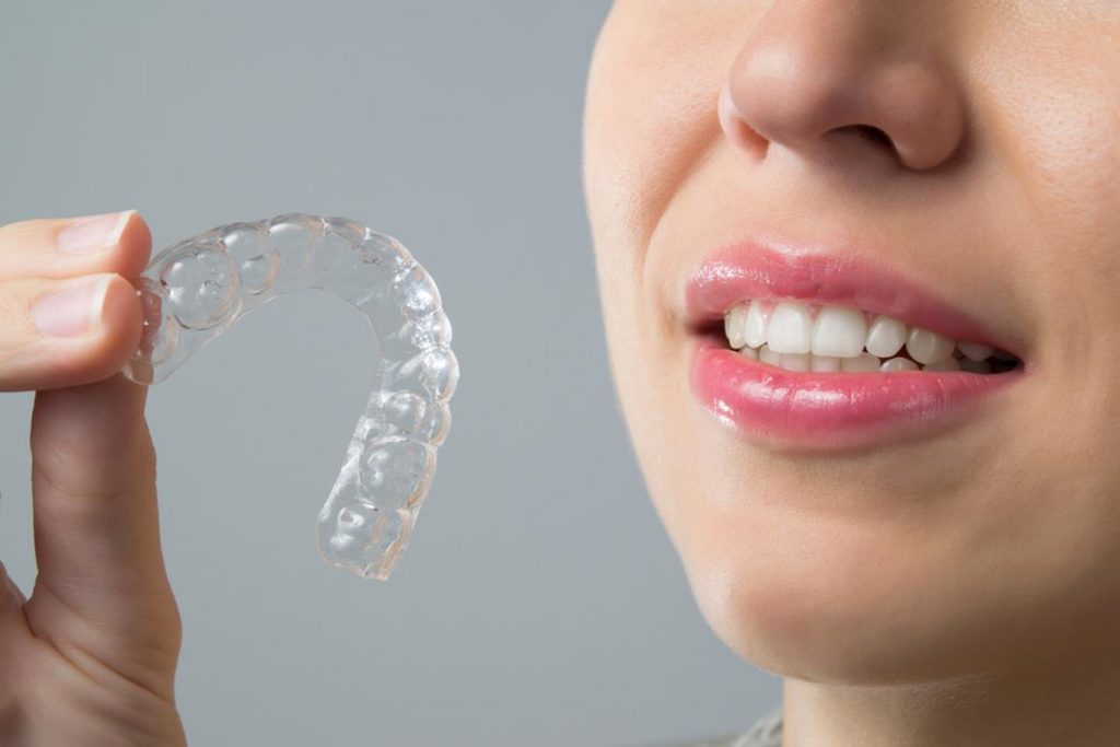 Types of Braces in Brookhaven and Columbia, MS | Leggett Orthodontics
